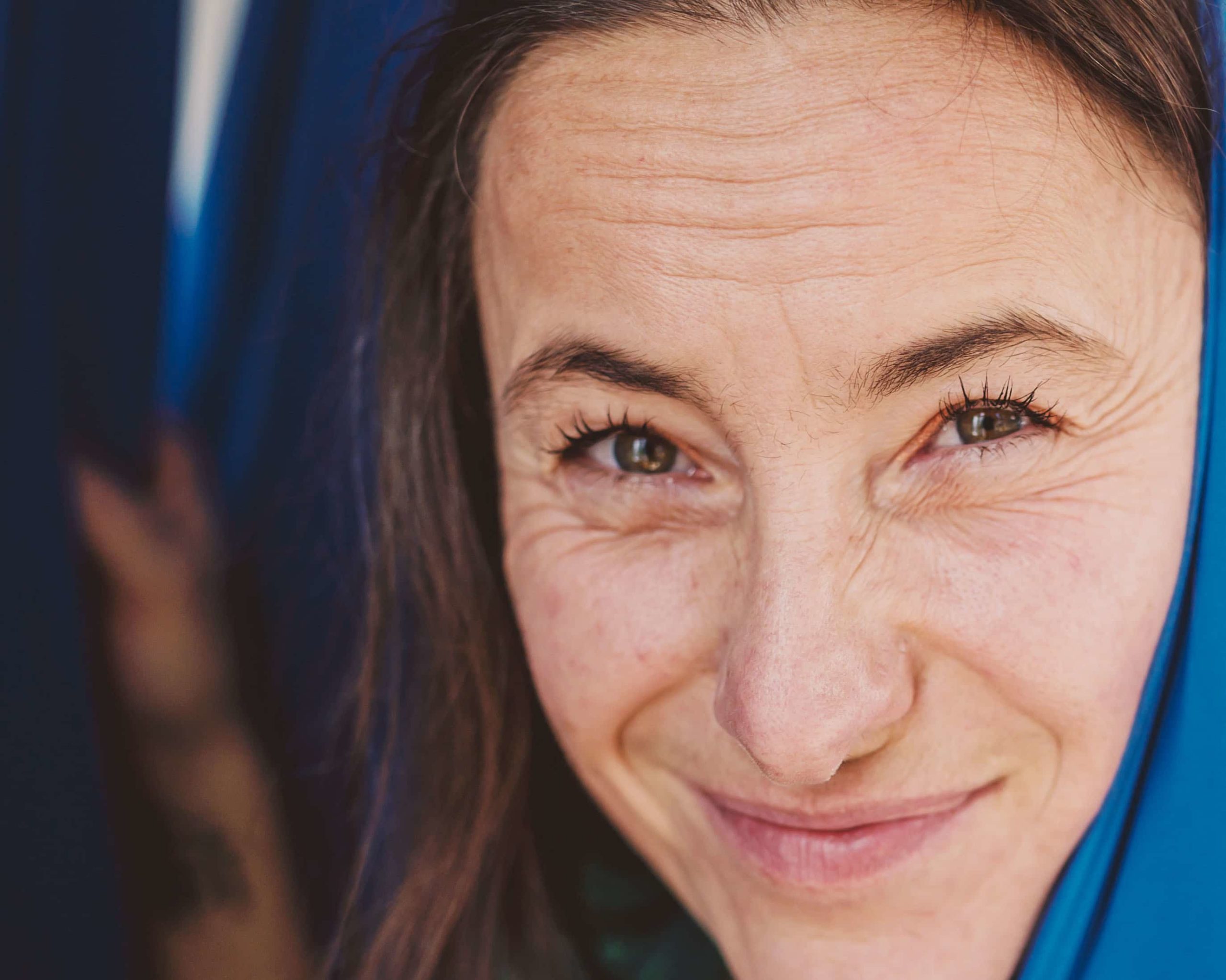 Les réponses à toutes vos questions sur le lifting du visage | Dr. Rossarie